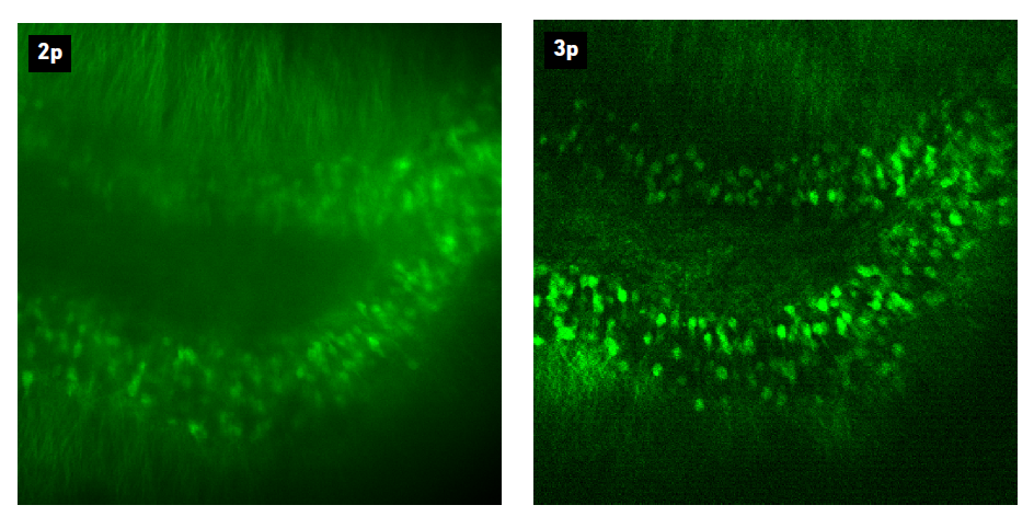 Hamburg experts work on three-photon microscopy systems for ...