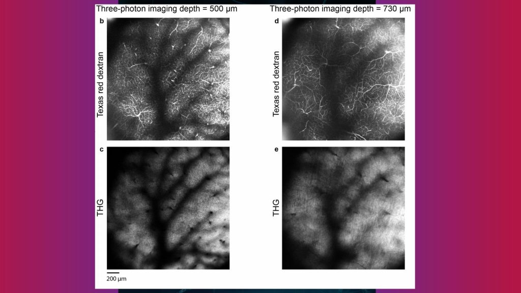 The Cousa Objective: A Game Changer in Multiphoton Microscopy - Class 5 Photonics